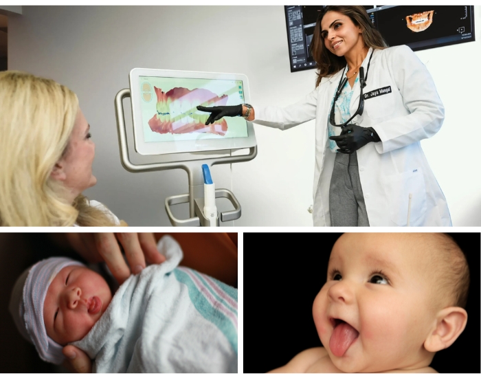 Tongue Tie Lip Tie Frenectomy In Cypress Tx Premier Dental Club